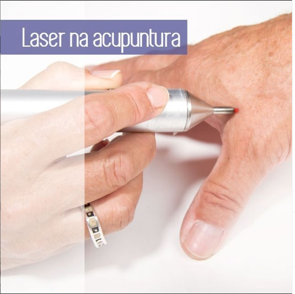 Benefits of Doing Acupuncture Using Laser – Facilitando Acupuntura